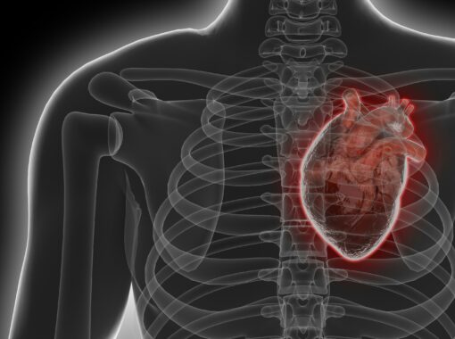 Dr. Jose Jacob | Invasive Cardiology Expert